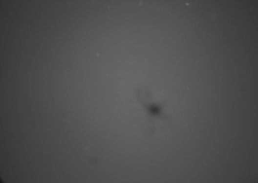 Fluorescent in situ Hybridization | Rachel Ouye | Professional Portfolio